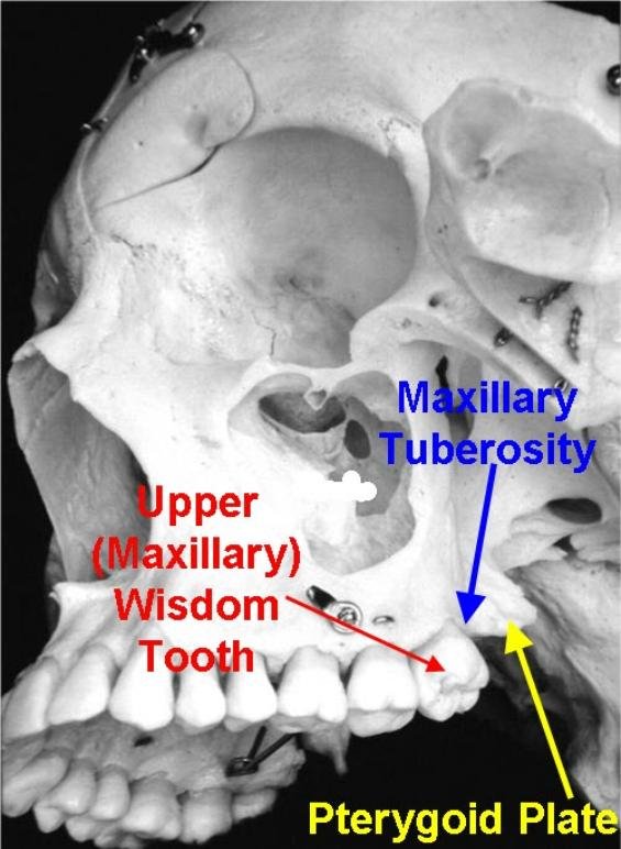 Maxillary Tuberosity 14 Dento Osseous Structures Blood Vessels And